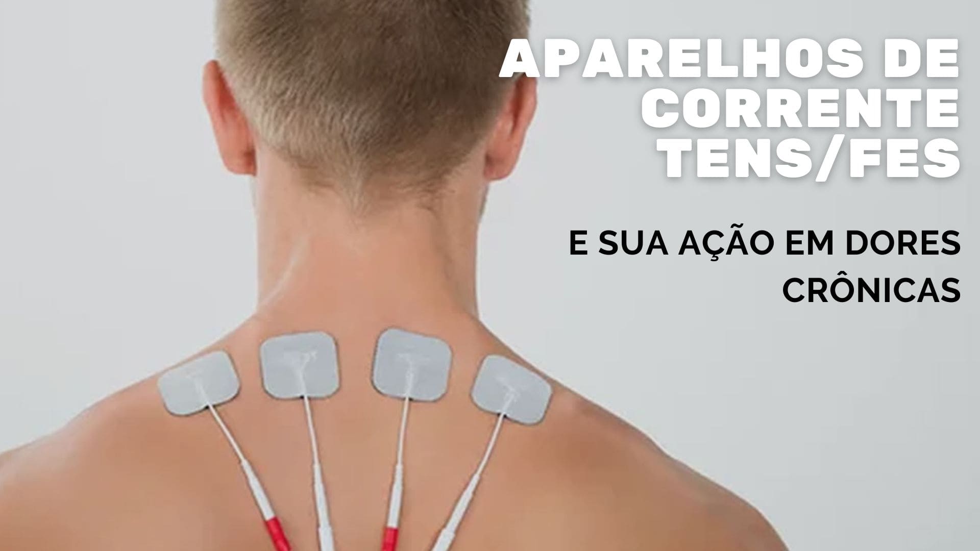 Como os aparelhos de TENS/ FES podem auxiliar pacientes com dor crônica